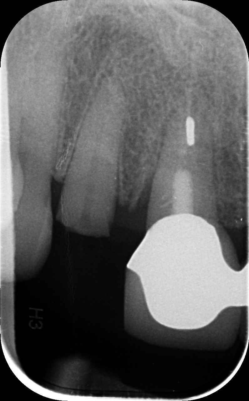 Treatment And Smile Gallery Pelican Dental Care